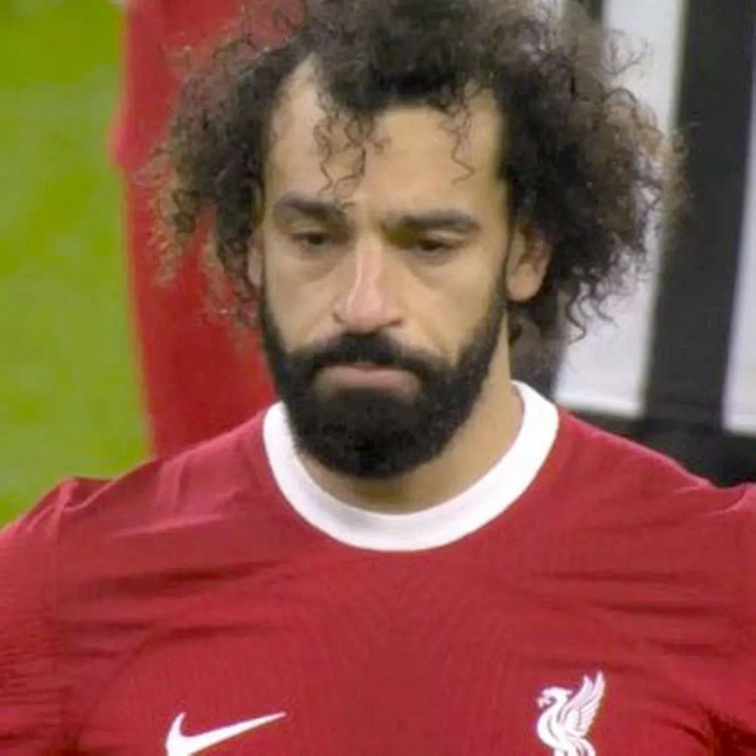 MOHAMED SALAH - TRAPIANTO DI CAPELLI
